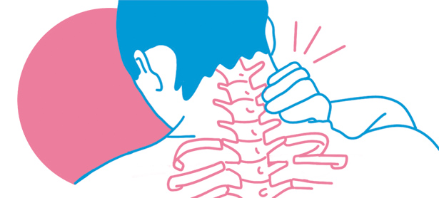 ¿Cómo saber si tengo una hernia cervical? Síntomas Hernia